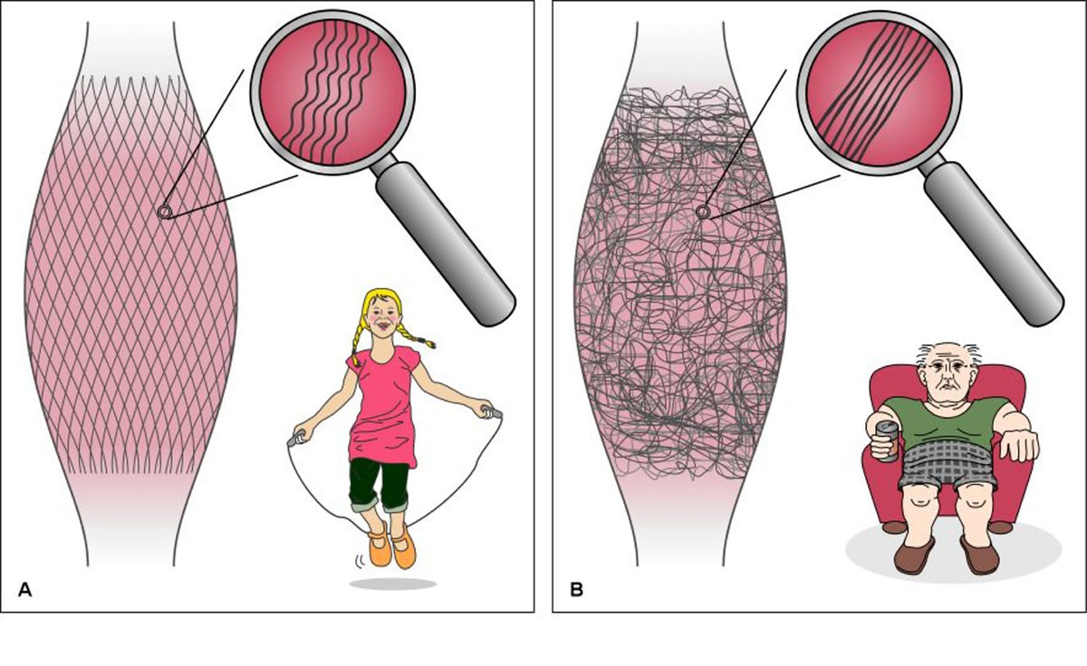 Fascia graphic 1 - Download – FASCIALNET.COM